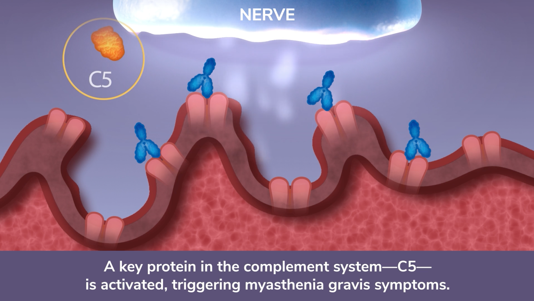 What Causes Myasthenia Gravis? | More Than MG